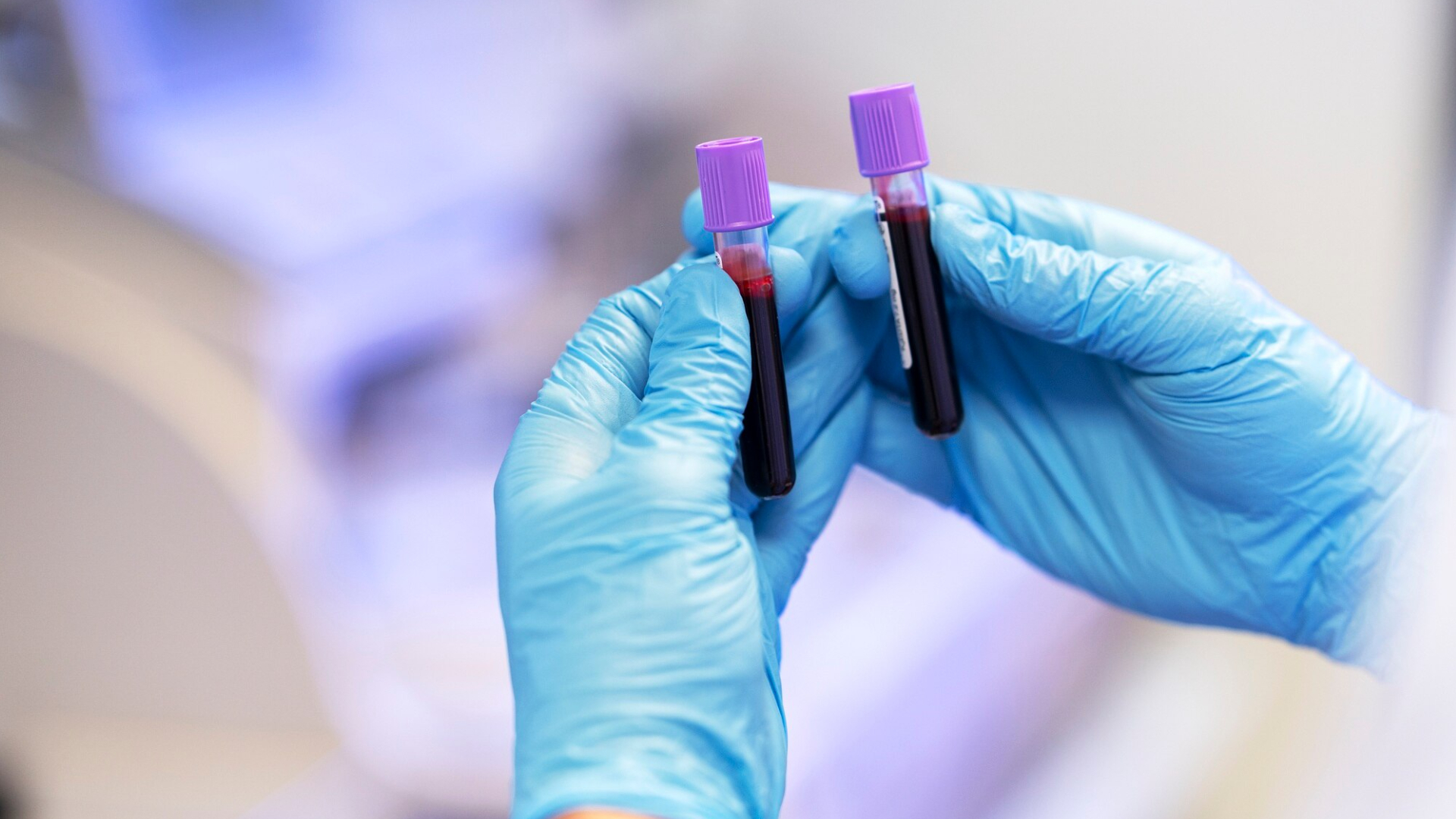 Subpopulações de linfócitos: quando solicitar o exame